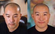 Scalp Micropigmentation Locations | Scalp Micro USA