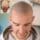 Matt Iulo Scalp Micropigmentation in NYC | Scalp Micro USA