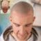 Matt Iulo Scalp Micropigmentation in NYC | Scalp Micro USA