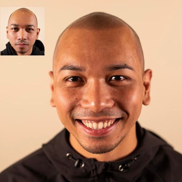 Ken Boyle Scalp Micropigmentation NYC | Scalp Micro USA